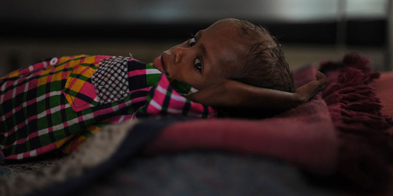 Govt reviews how stunting is measured | malnutrition | poshan abhiyan ...